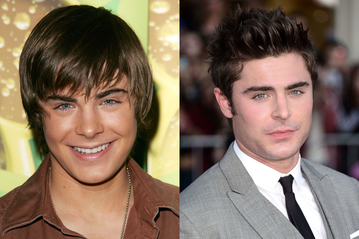 Zac Efron Se Serait Fait Refaire Le Nez Chirurgie Esthétique Les